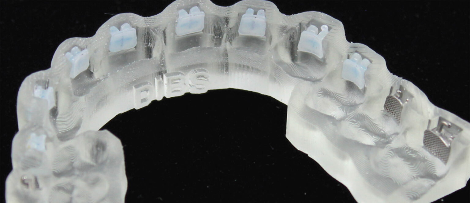 Stratasys J5 Dentajet : Dental 3D Printer